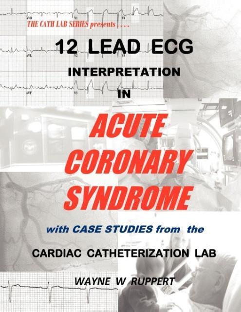 12 Lead ECG Interpretation in Acute Coronary Syndrome with Case Studies ...