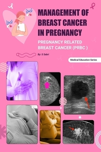 Management of Breast Cancer in Pregnancy: Pregnancy related Breast ...